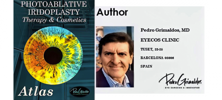 Cínica Eyecos - Cambio del color de los ojos mediante láser