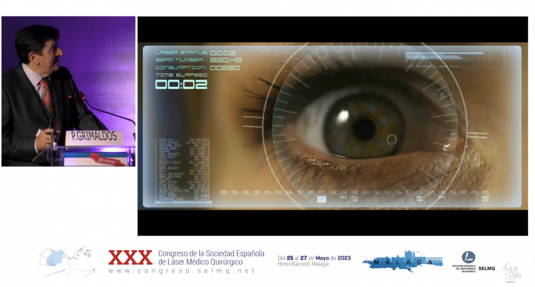 Clínica Eyecos - Cambio del color de los ojos mediante láser