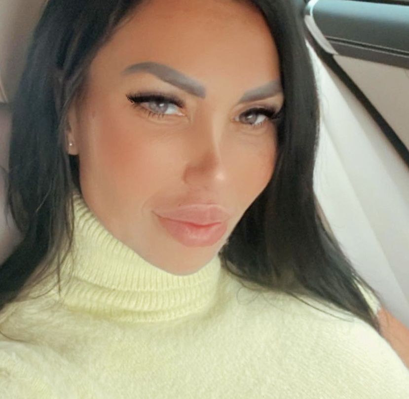 NewEyes Laser: the true & safe eye color change - Clínica Eyecos ...