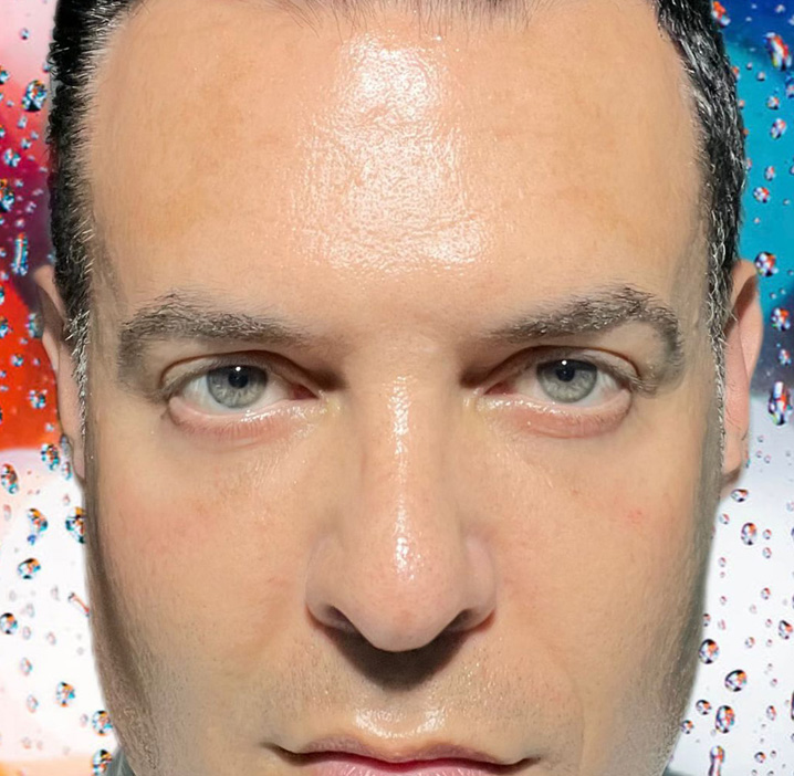 NewEyes Laser: the true & safe eye color change - Clínica Eyecos ...