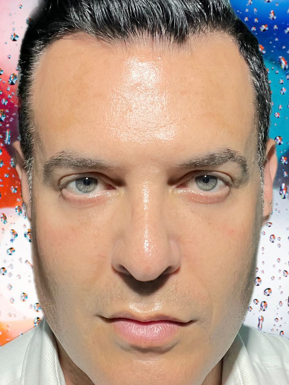 Clínica Eyecos - Cambio del color de los ojos mediante láser