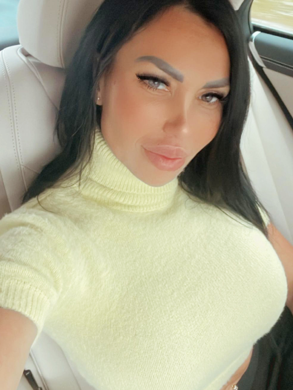 Clínica Eyecos - Cambio del color de los ojos mediante láser