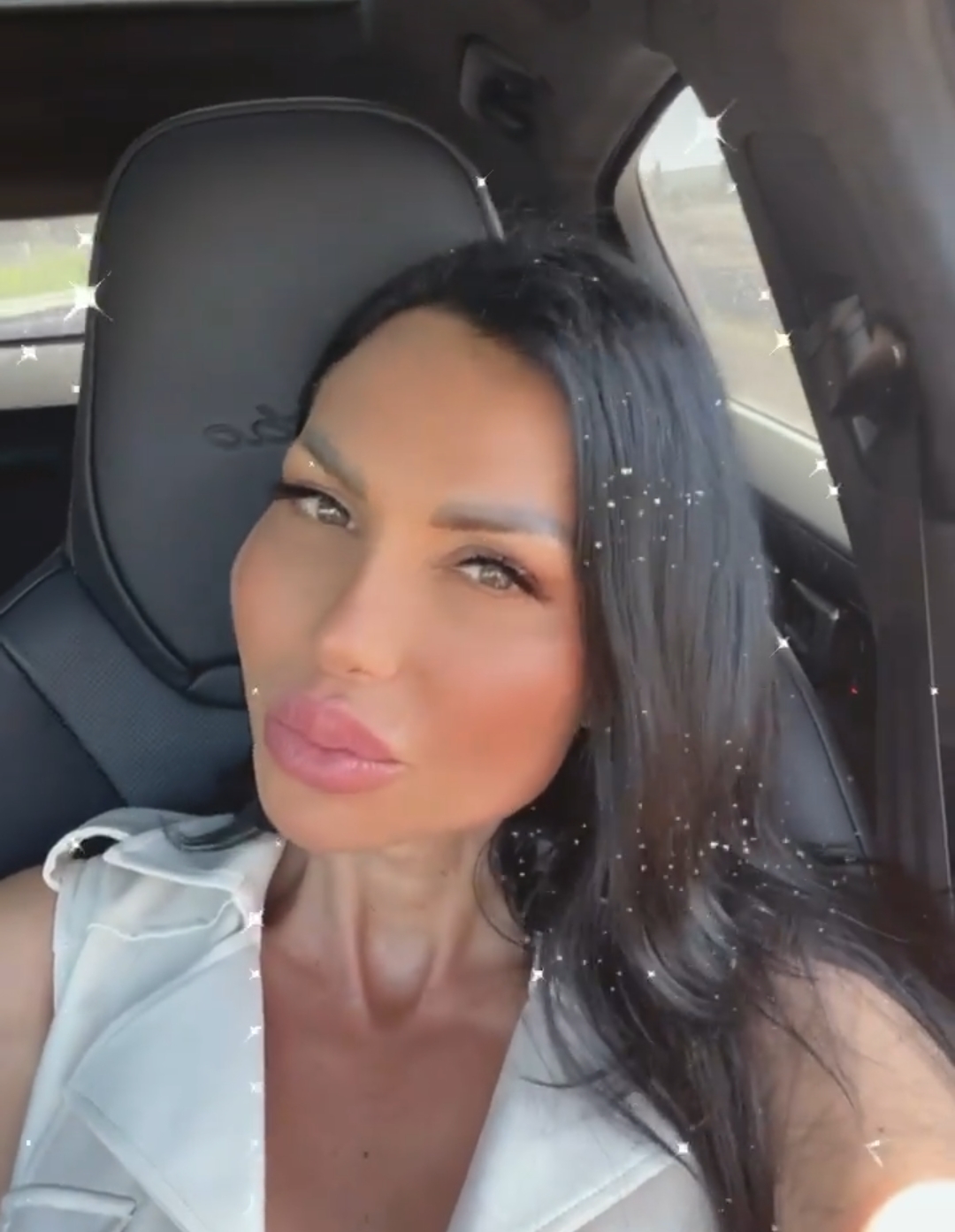 Images of before and after the treatment of eye color change - Eyecos ...